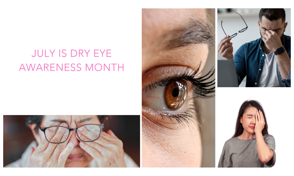 July Is Dry Eye Awareness Month | The Opticians